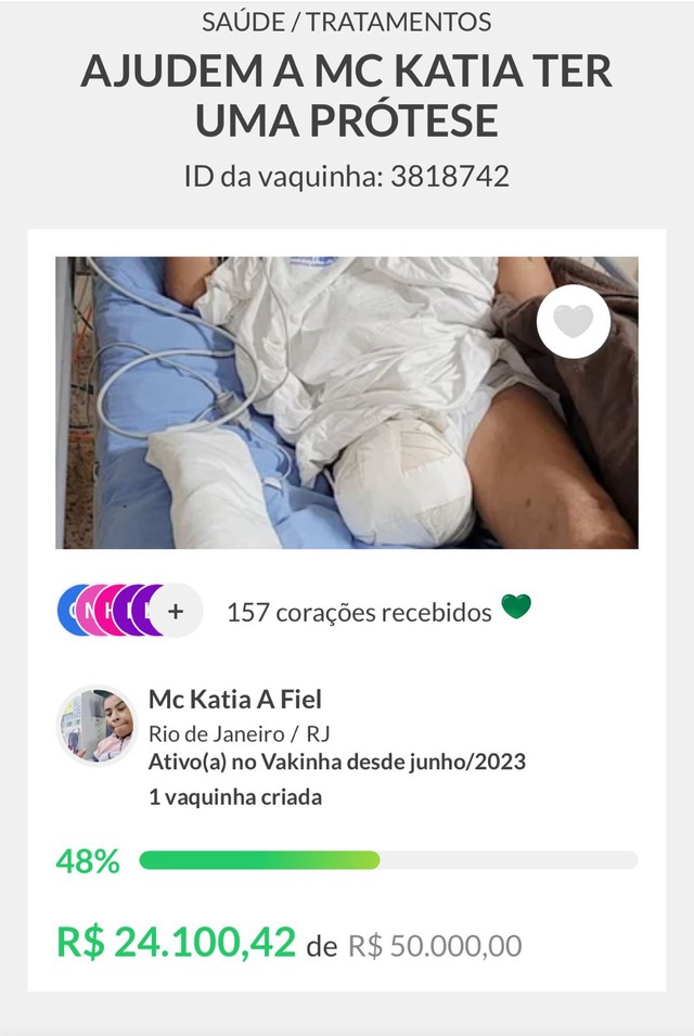 Vaquinha para prótese de MC Katia que teve perna amputada arrecada