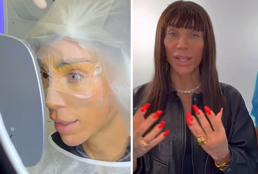 Maya Massafera mostra cirurgia para mudar cor dos olhos: 'Deixou meu ...