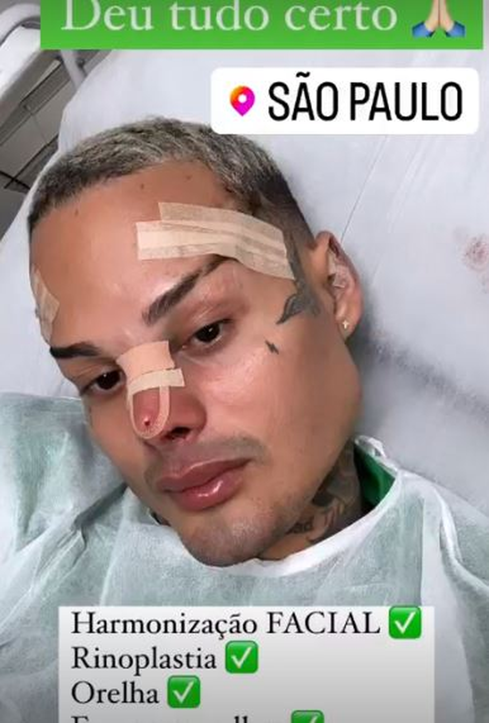 Influenciador diz que gastou mais de R$ 100 mil para 'ficar a cara' de Cauã Reymond e viraliza ...