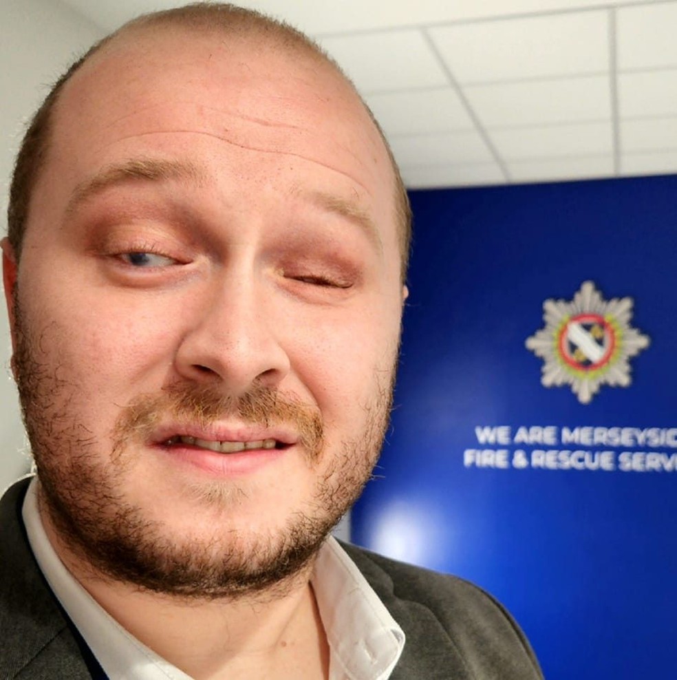 Deficiente visual escala arbustos e cerca de arame farpado para salvar ...