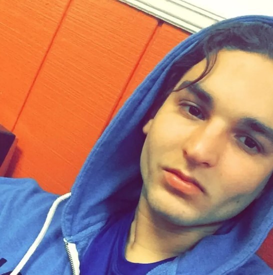 Homem submetido ao primeiro transplante de rosto e mãos revela reação ...