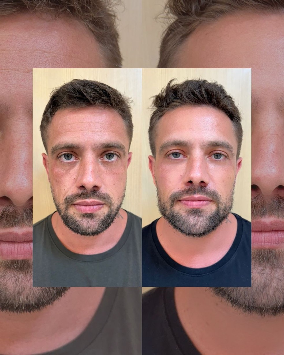 De volta à web, Rafael Cardoso passa por harmonização facial: 'Saiu de ...