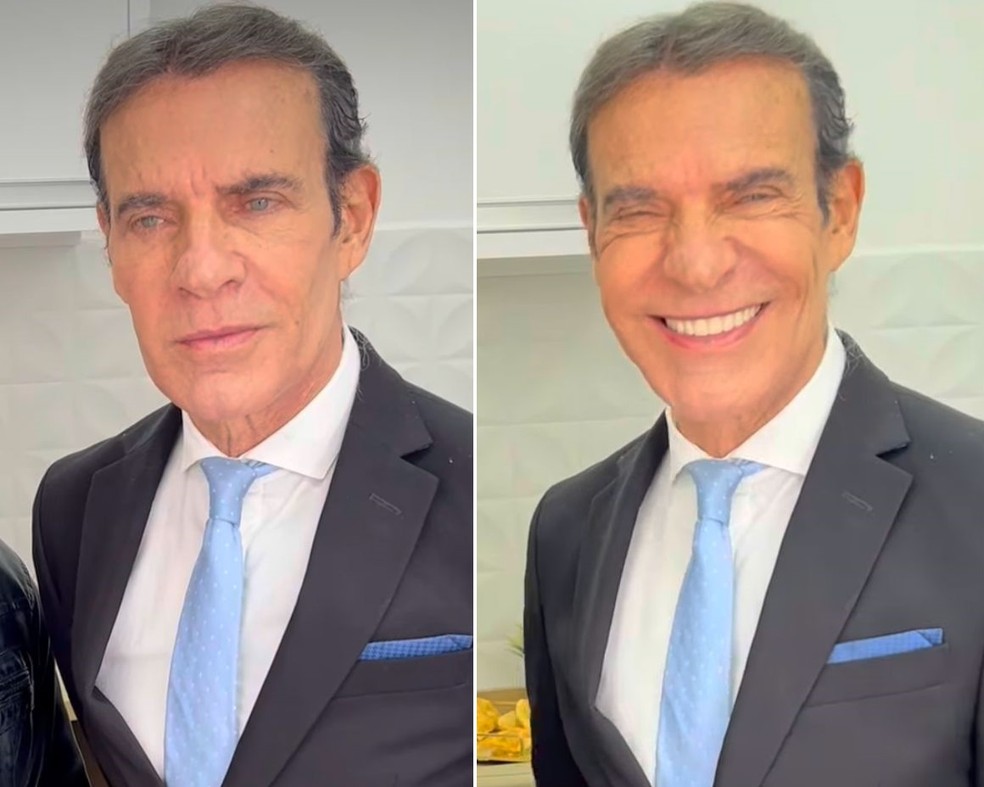 Mário Gomes exibe novo visual após harmonização facial e implante ...