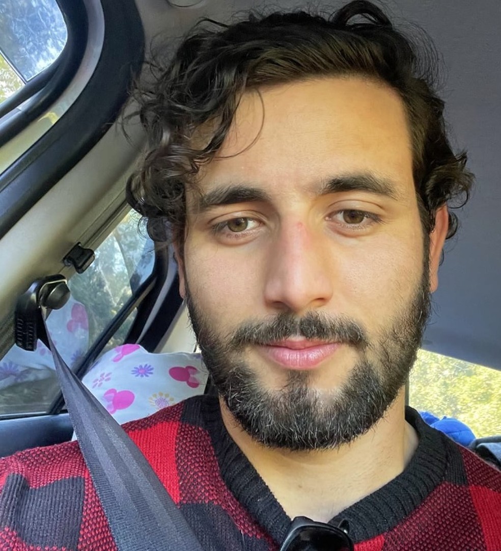 Veja os procedimentos estéticos de Matteus, do 'BBB 24', e as mudanças ...