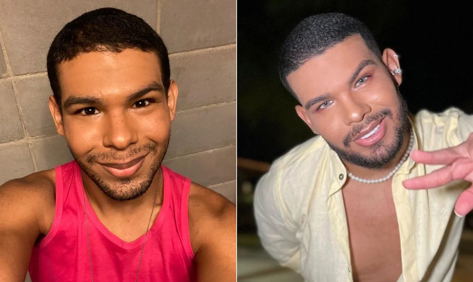 Juju do Pix mostra rosto, dez dias após cirurgia para retirar óleo ...