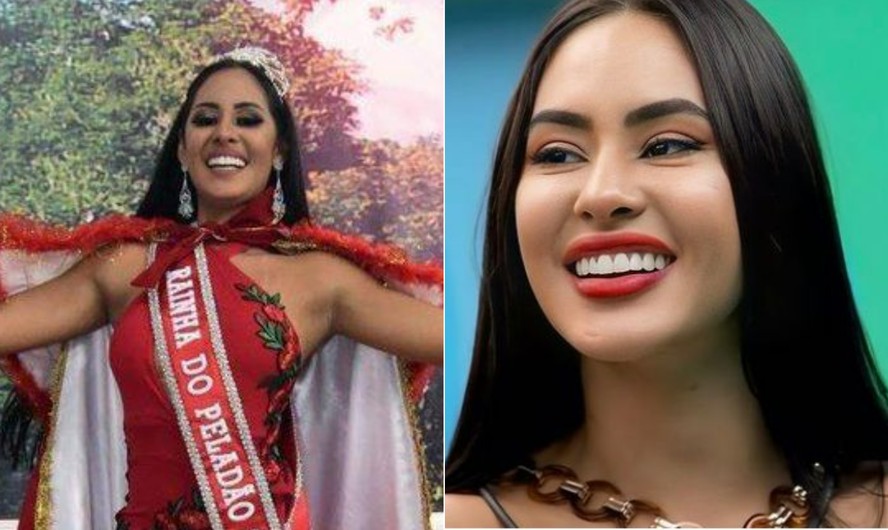 Como Isabelle, do 'BBB 24', mudou a aparência? Médico e mãe da sister ...