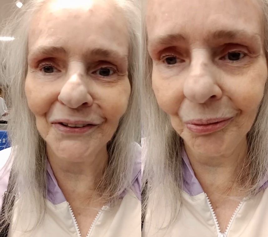 Angela Ro Ro diz que está com 'suspeita de câncer' e pede ajuda ...