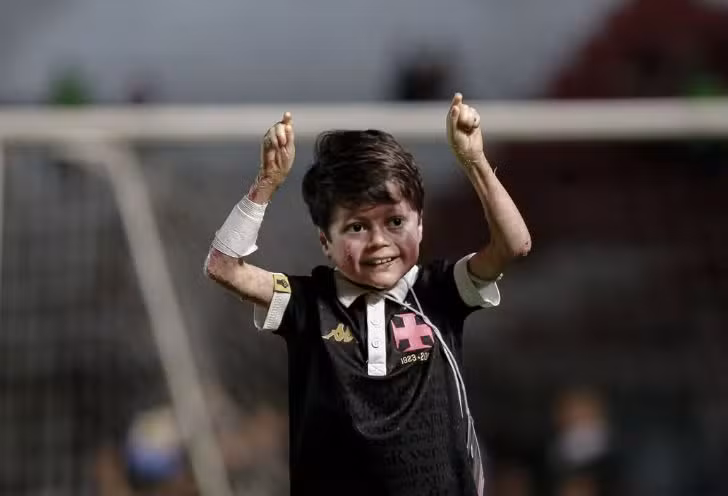 Torcedor do Vasco, Menino Gui recebe alta de hospital após procedimento ...