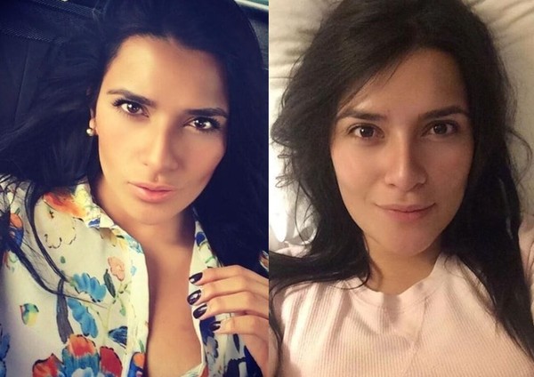 Estrela no México, Dania Mendez recorreu a cirurgias antes da fama: fotos