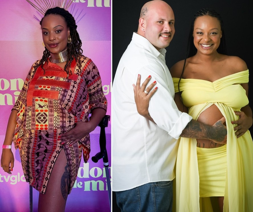 Atriz PCD de 'Dona de mim' teve a perna amputada aos 8, é casada com ...