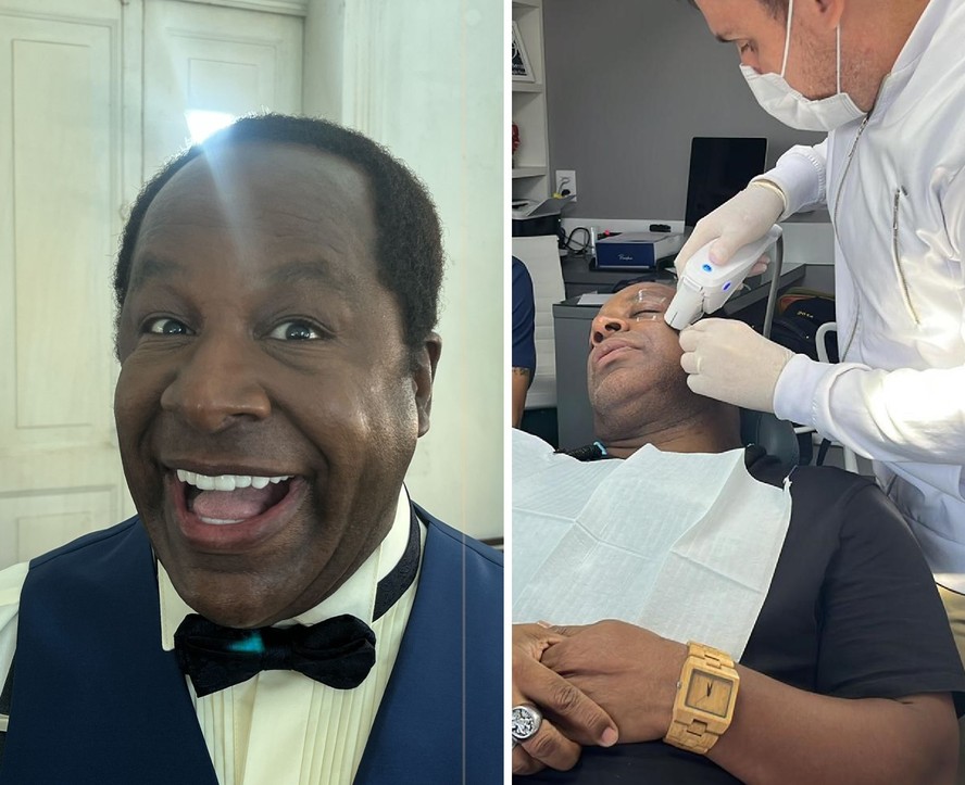 Aílton Graça fez procedimento com o próprio sangue para viver Mussum no ...