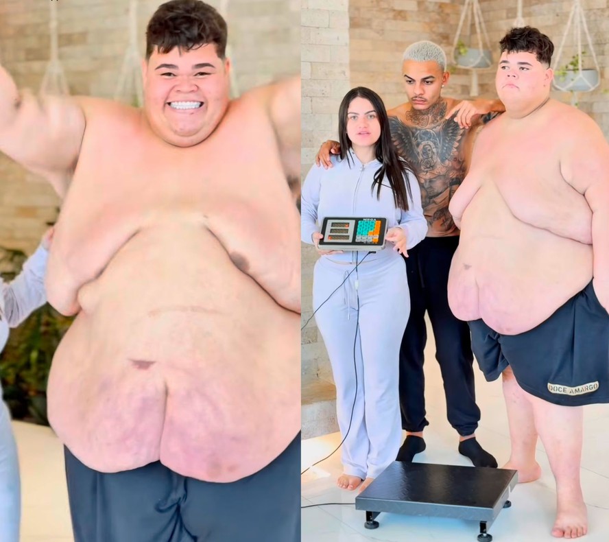 Gordão da XJ bate novo recorde, perde 115kg e se prepara para cirurgia bariátrica: 'Não dá nem ...