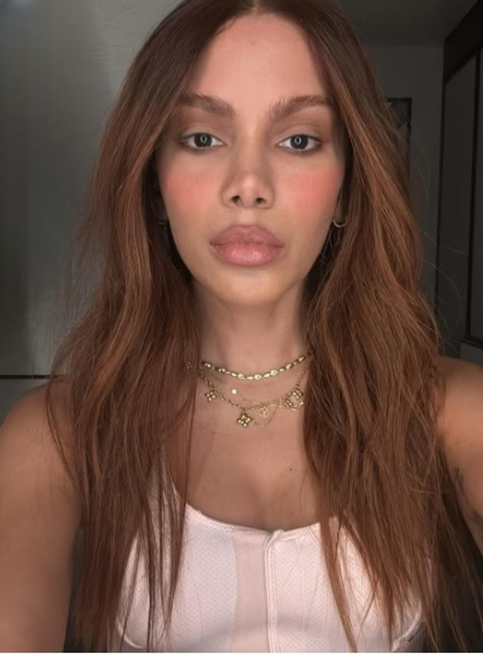 O que Anitta fez no rosto? Especialista cita procedimentos que podem ...