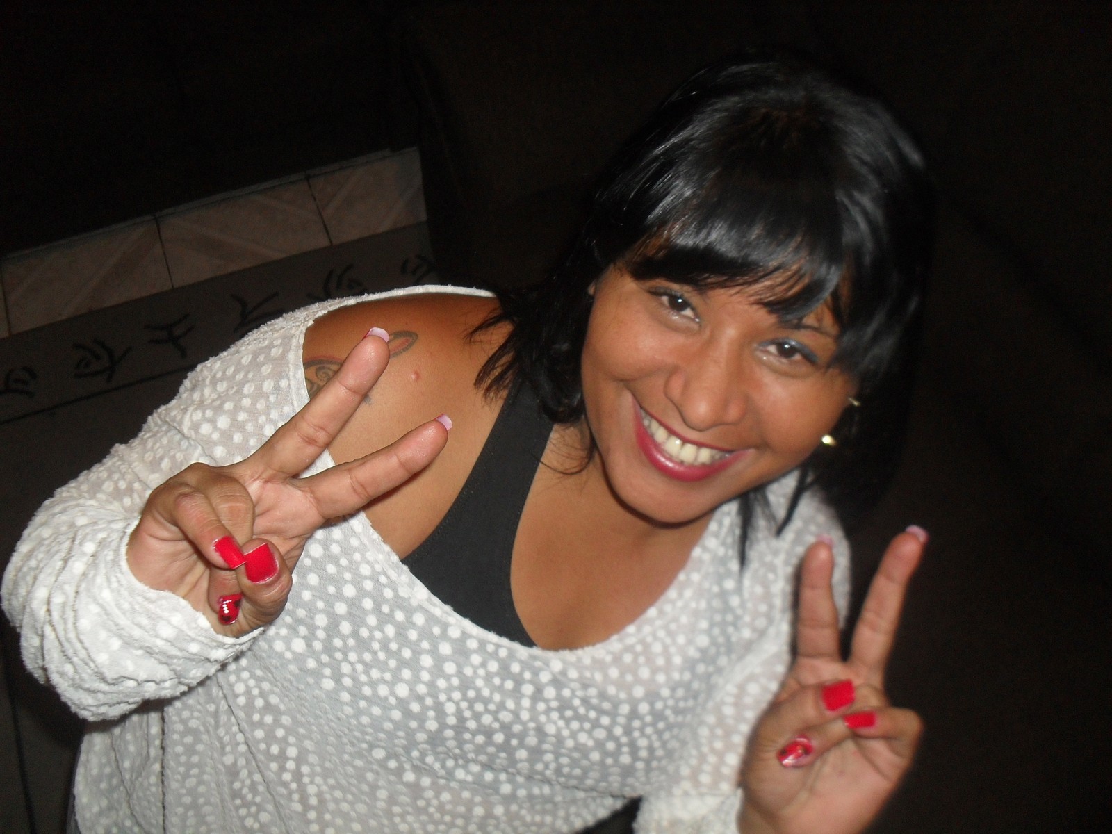 MC Katia faz cirurgia para retirar mioma e diz que perderá metade de pé