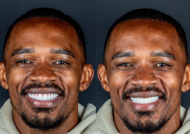 Ex-Miss Bumbum fala sobre rumores de affair com pai de Endrick, do Real ...