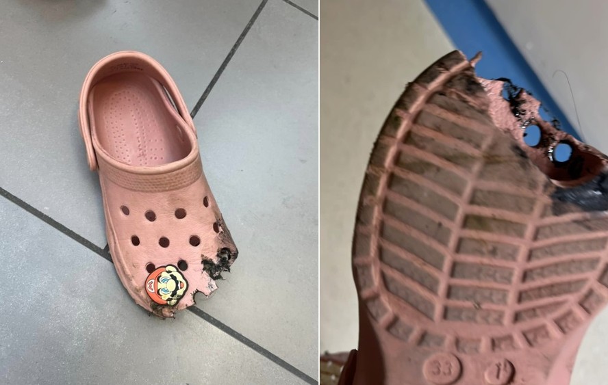 Mulher faz alerta após filha sofrer acidente em escada rolante