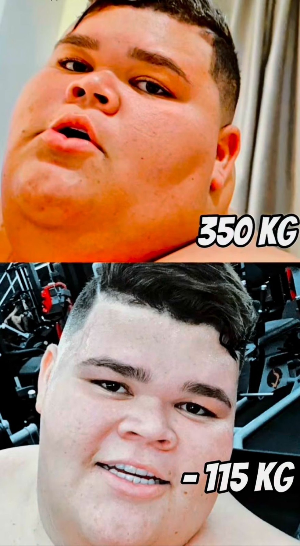 Com menos 115kg, Gordão da XJ planeja realizar cirurgia bariátrica ano ...