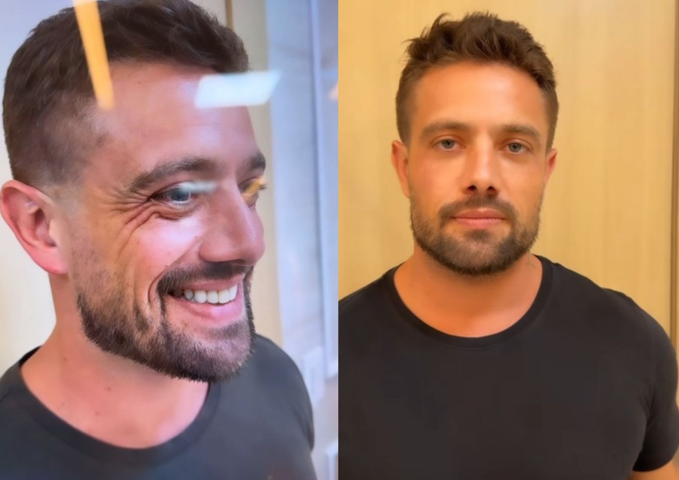 De volta à web, Rafael Cardoso passa por harmonização facial: 'Saiu de ...