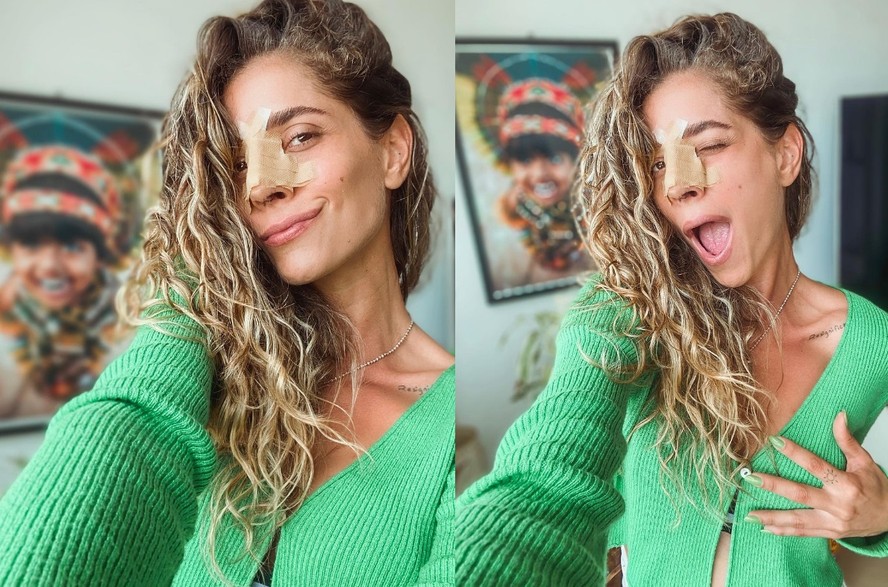 Maria Joana explica sumiço das redes ao mostrar cicatriz e curativo no ...