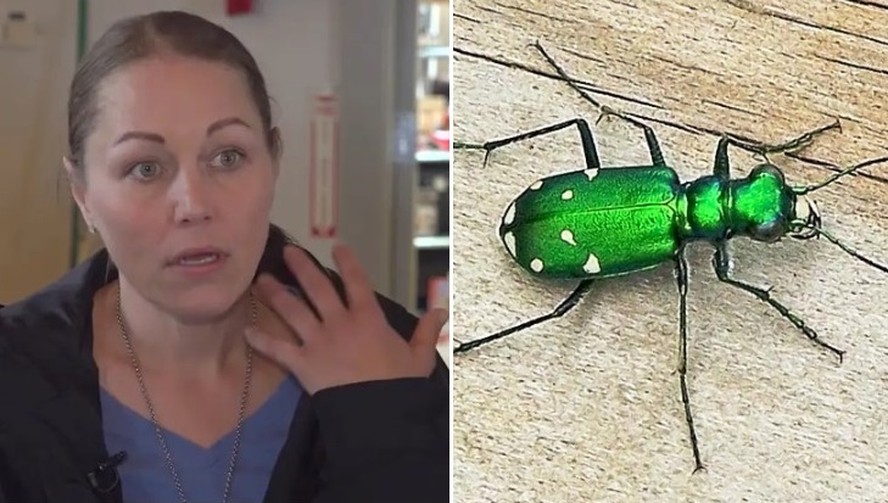 Mulher pega besouro 'fofo' em parque e tem rara reação alérgica que ...