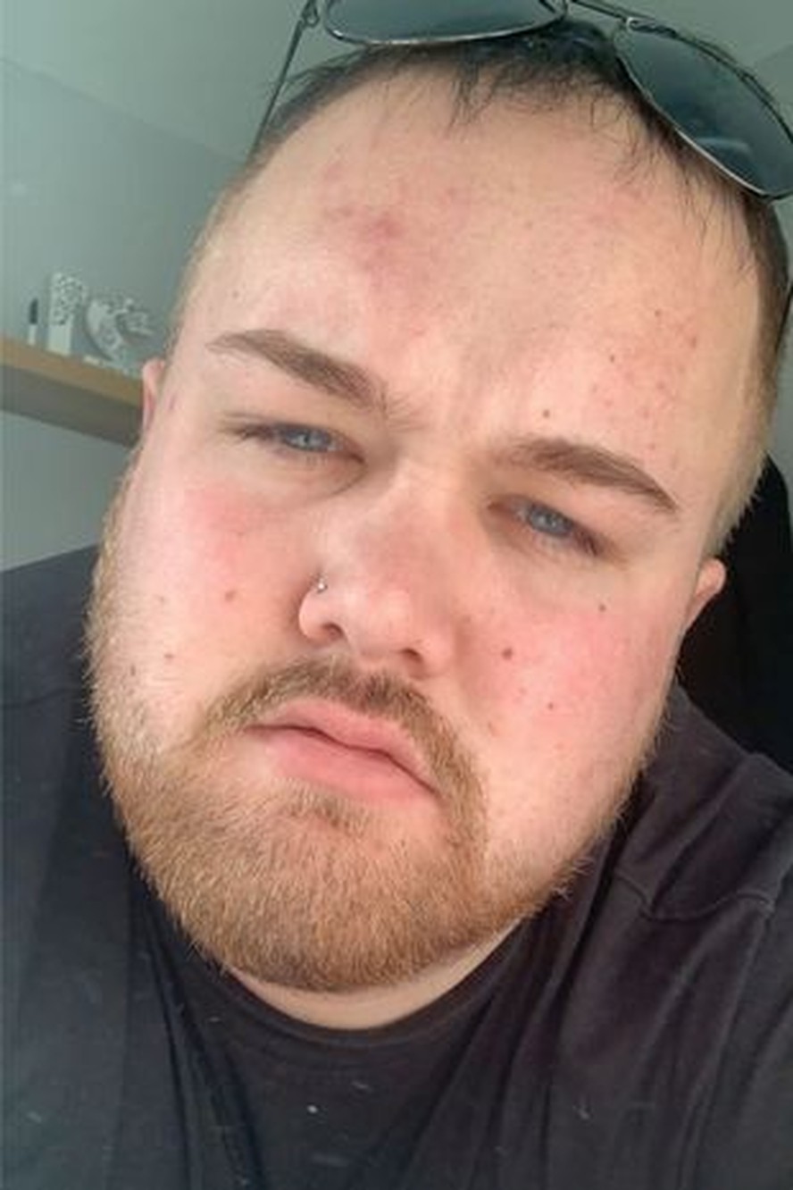 Homem leva susto ao acordar ao lado de estranho nu em hotel de luxo