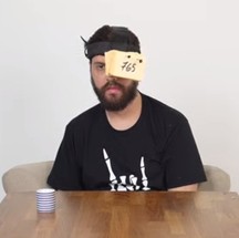 'Ficou bonitinho': Diogo Defante comemora cirurgia no olho e lembra ...