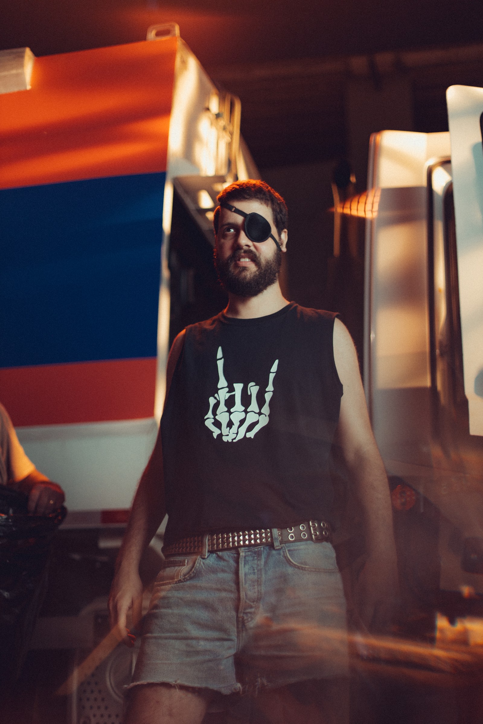 'Ficou bonitinho': Diogo Defante comemora cirurgia no olho e lembra ...