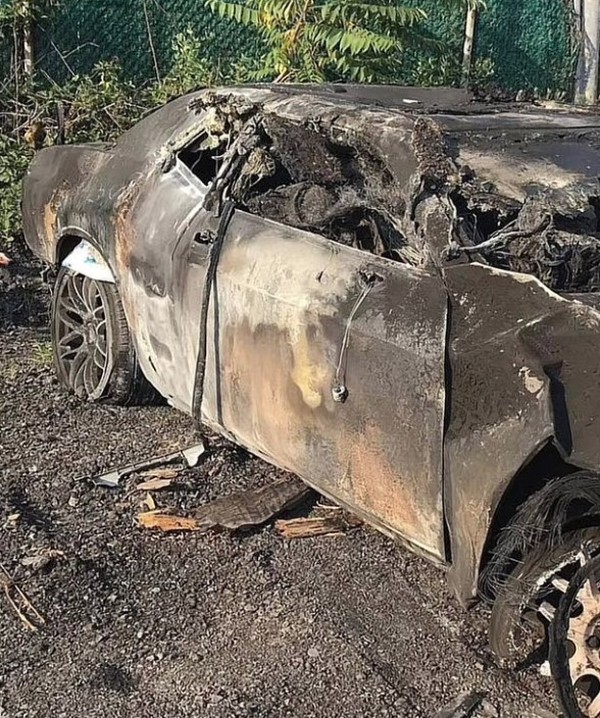 Americano que passou por transplante duplo após grave acidente de carro ...