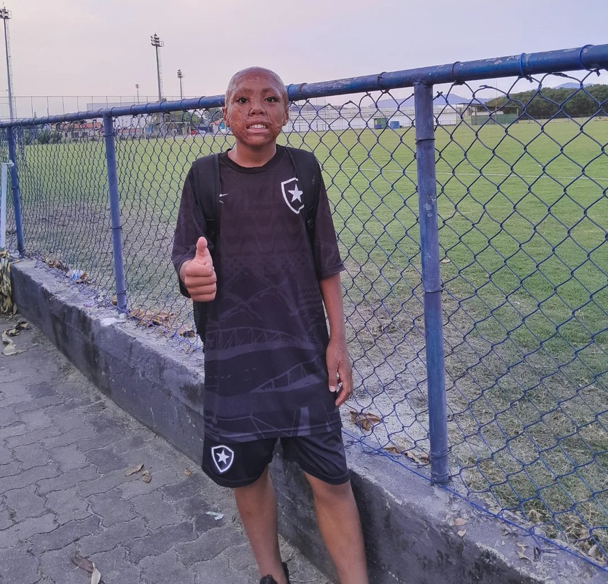 Conheça Bernardo Lopes, jogador do sub-11 do Botafogo que sofreu um ...