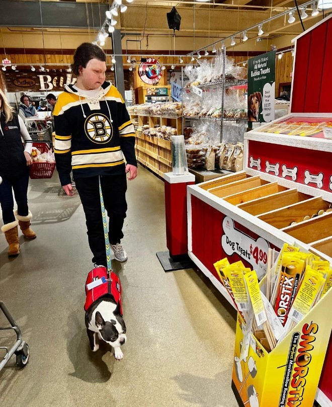 Primeiro a passar por transplante de rosto e mãos comemora 'ter ...