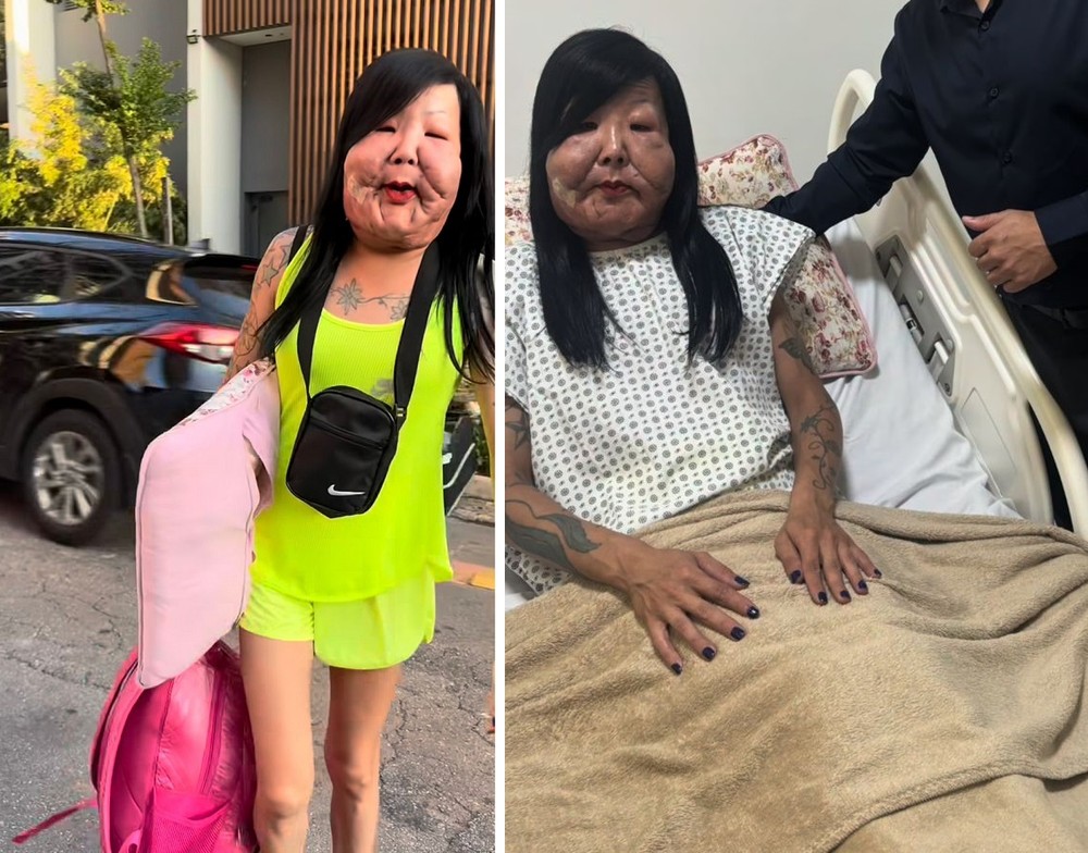 Juju do Pix celebra prótese de 550 mil de silicone nos seios: 'Amando'