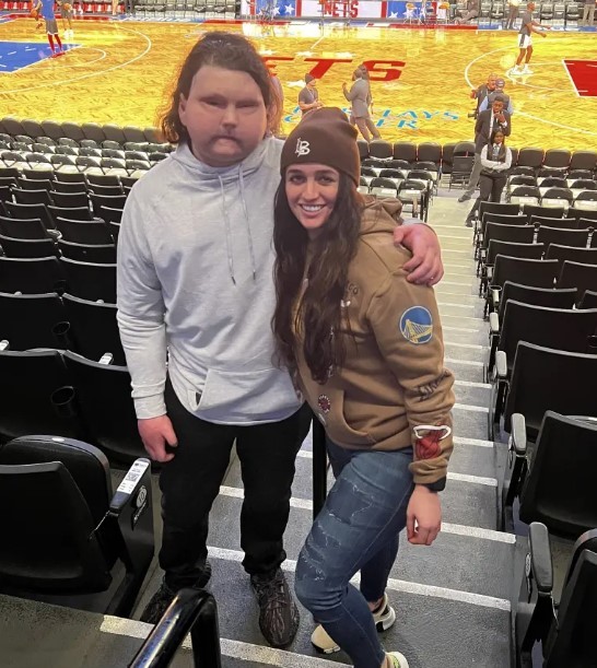 Primeiro a passar por transplante de rosto e mãos comemora 'ter ...