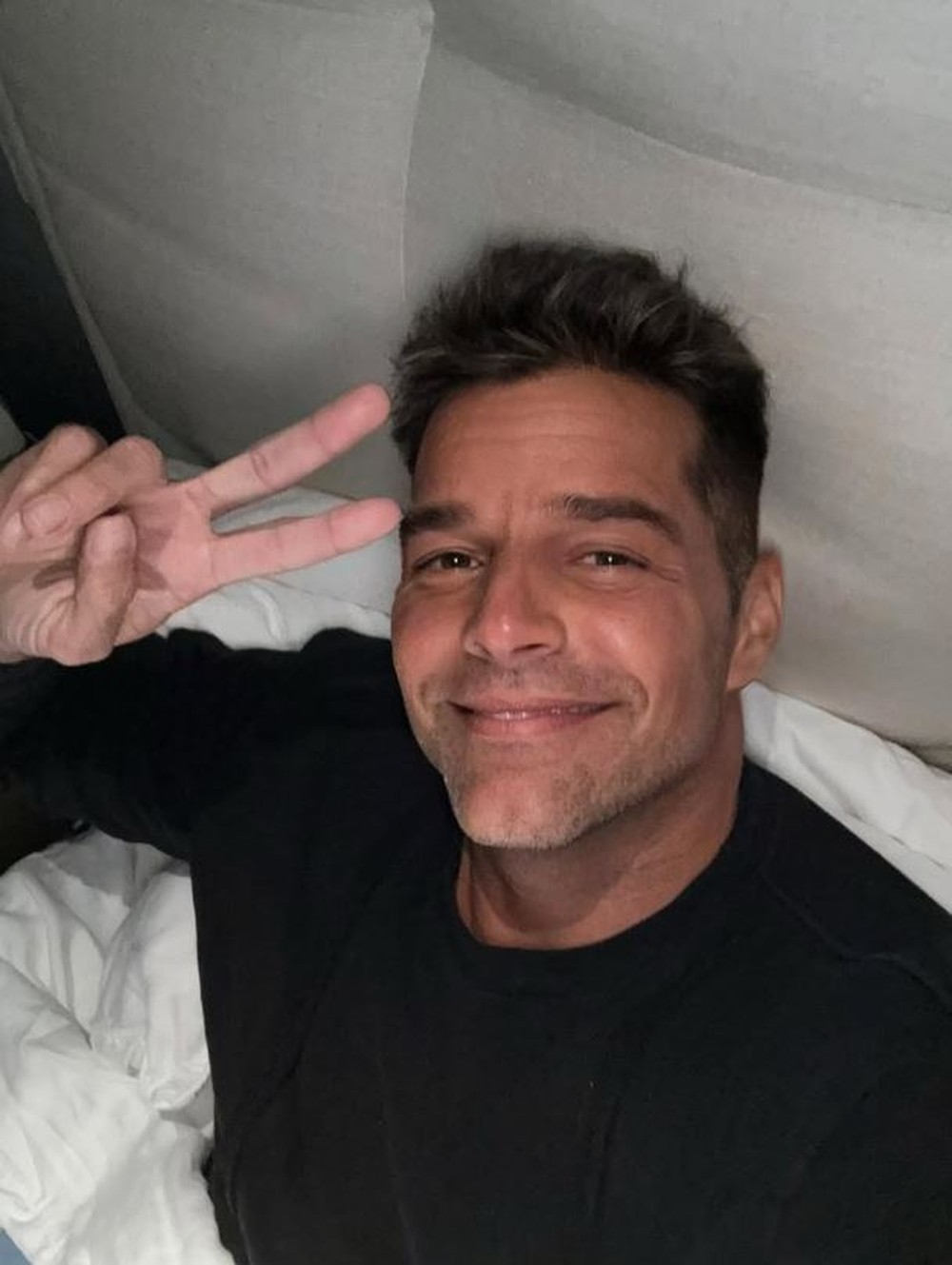 Bioestimulador, lifting nos olhos, ácido realocado: Ricky Martin usa ...