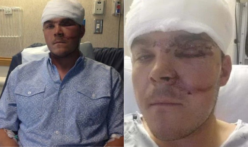 'Tive que enfiar um braço na garganta dele': caçador sobrevive a ataque ...