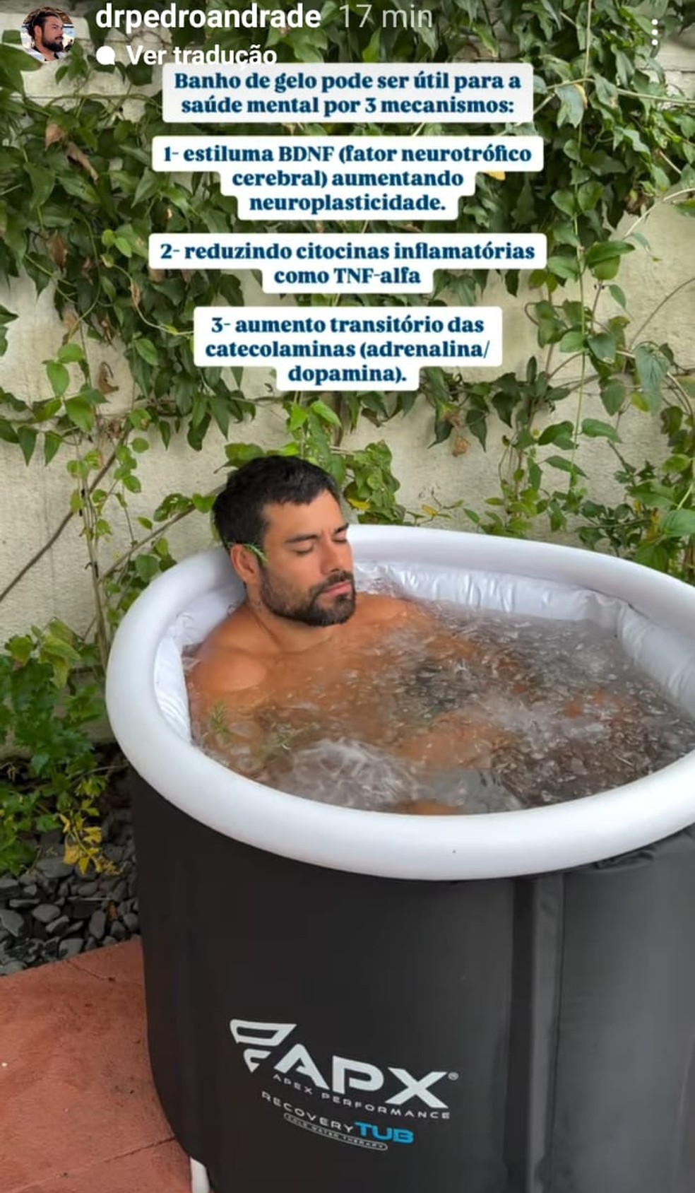 Namorado médico de Sandy surge em banho de gelo e brinca após viralizar ...