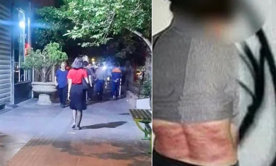 Iraniana é açoitada com 74 golpes após aparecer sem véu em público