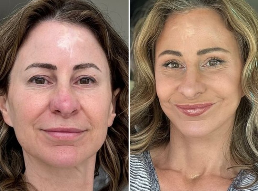 Mulher que vendeu a casa e se submeteu a plástica para ficar '20 anos ...